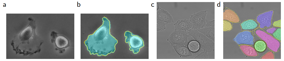 Deep Learning for Image Segmentation: U-Net Architecture - Fritz ai