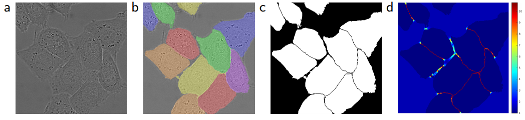 Deep Learning for Image Segmentation: U-Net Architecture - Fritz ai