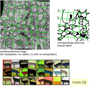 Deep Learning for Image Segmentation: U-Net Architecture - Fritz ai